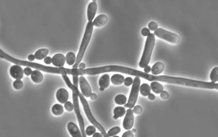 Lutter contre la candidose : les cellules qui tiennent en échec les ...