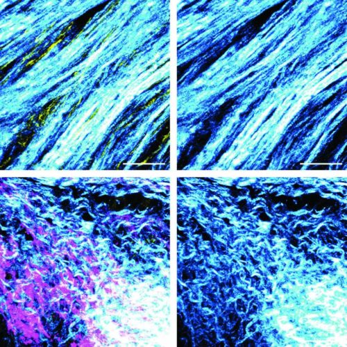 Fibres de collagène déposées par les fibroblastes dans le ...