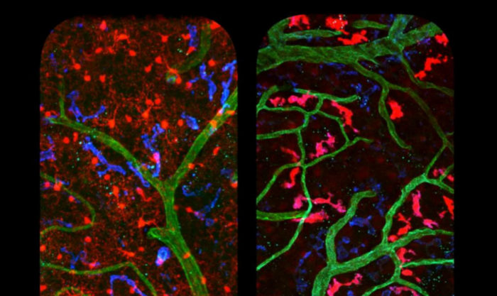 En rouge, la microglie (à gauche) et les macrophages périvasculaires (à ...